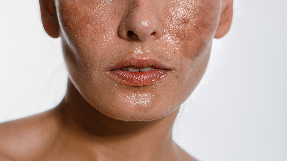 Green Light Therapy: Beauty, Health, and Well-Being Benefits | FOREO